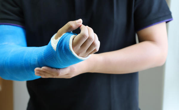 How Long Does a Cast Stay On? What Parents Should Know